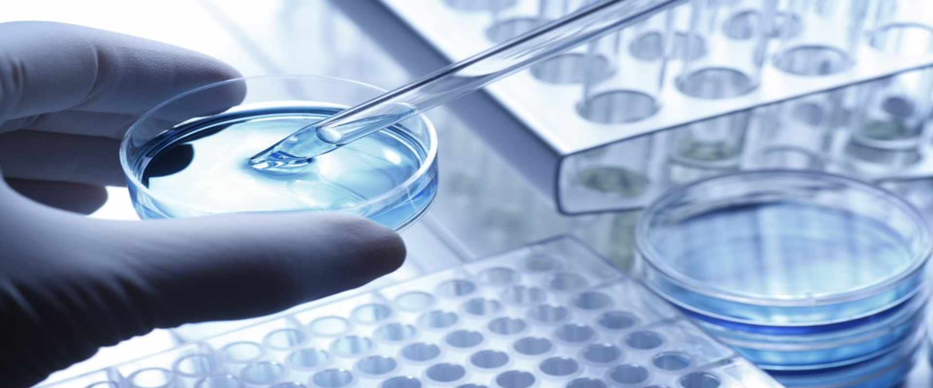 Custom Research for Expansion into US HbA1c Market | Infiniti Research